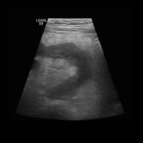 Appendix Gallery Sonographic Tendencies