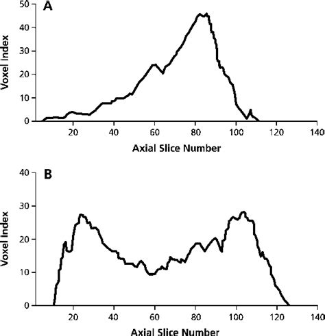 Figure 2 From Patient Phenotyping And Early Disease Detection In Chronic Obstructive Pulmonary