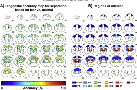 Figure 4 From Fmri Pattern Recognition In Obsessivecompulsive Disorder Semantic Scholar