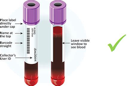 General Laboratory Test Information