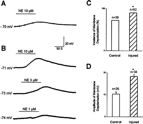 Subthreshold Membrane Potential Oscillation Mediates The Exc Pain