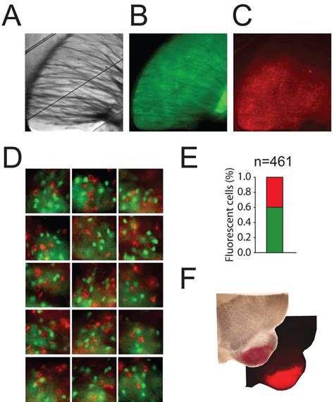 Retrograde Labeling Of Striatonigral Neurons With Florescent Latex Download Scientific Diagram