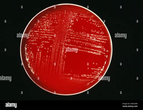 Listeria Bacteria Listeria Monocytogenes Colonies White Being