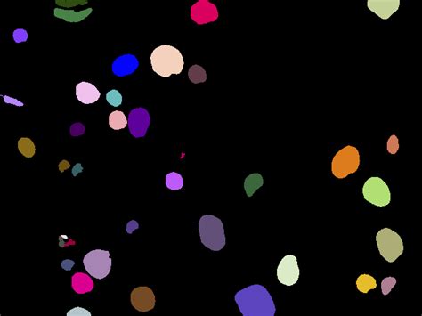 Help Needed On Image Analysis Using Imagej Image Analysis Image Sc