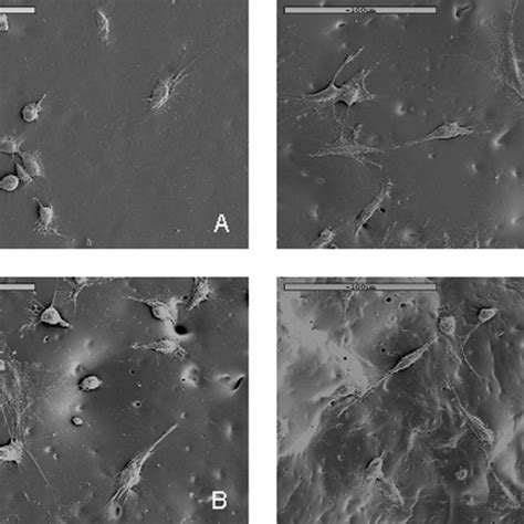 Scanning Electron Microscope Pictures Of Fibroblasts Adhered On Download Scientific Diagram