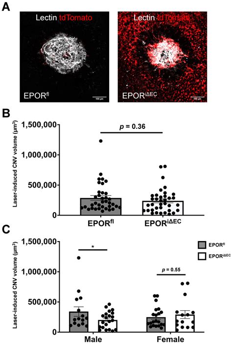Epor Knockout In Endothelial Cells Reduced Laser Induced Cnv In Male Download Scientific