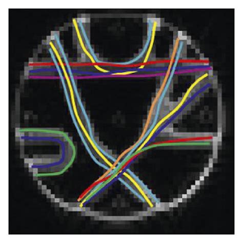 fiber pathways tracked with fact nurbs t and nrbs g a spatial seed download scientific