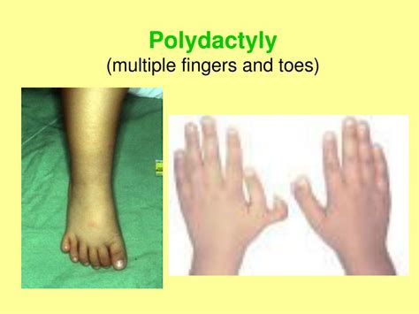 Ppt Human Heredity Powerpoint Presentation Free Download Id 6335059