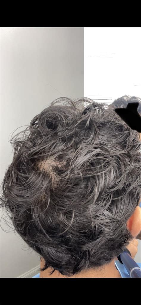 Am I Balding Thinning Or Am I Just Paranoid R Amibalding