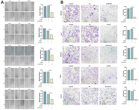 Metastasis Related Gene Signature Associates With Immunity And Predicts Prognosis Accurately In