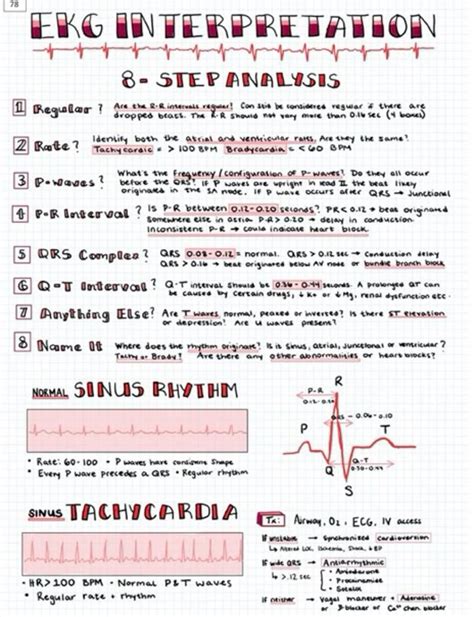 Ecg Interpretation Artofit