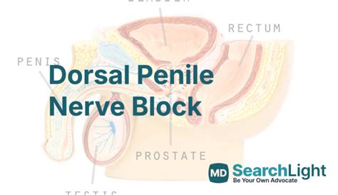 Dorsal Penile Nerve Block Md Searchlight