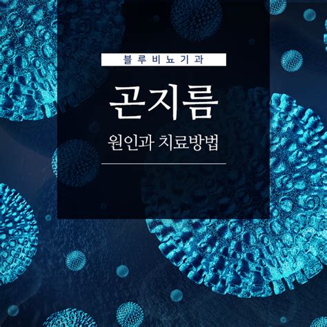 블루비뇨기과 ♠ 곤지름 콘딜로마 의 증상과 치료 ♠ 곤지름이란 ‘곤지름 이나 ‘콘딜로마 라는