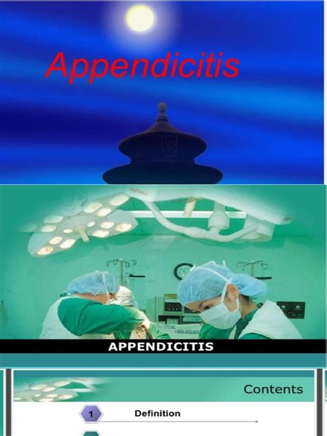 Appendicities 1 Pdf