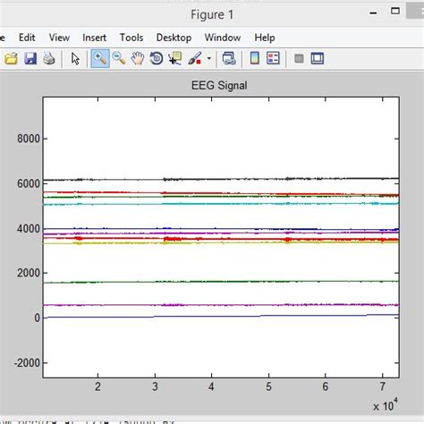 Real Time Eeg Signals Download Scientific Diagram