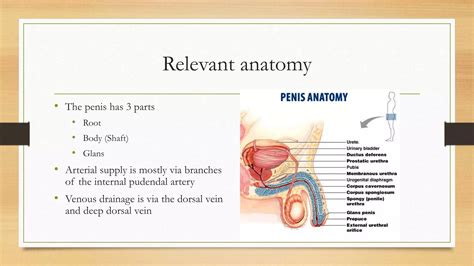Penile Fracture Pptx