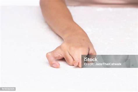 장애인은 어린 시절부터 손가락이없는 손 흰색 배경에 엄지 손톱이 분리되어 있지 않습니다 여성 손 핸디캡 쇼 제스처는 팔을 가진 장애와 수술 상처로 손가락을 쪼개기 위해