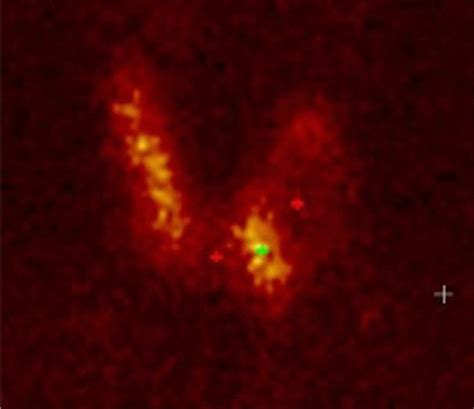 99mtc Planar Thyroid Scan Showing A Cold Left Thyroid Nodule Download Scientific Diagram