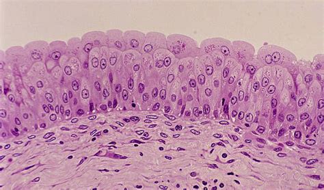 Transitional Epithelium Of Human Bladder H E Stain Cells Near The