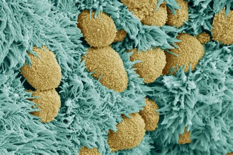 Choroid Plexus Location Structure And Function Choroid Plexus Location Structure And Function