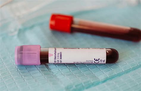 Blood Tests GenderGP Transgender Healthcare Services