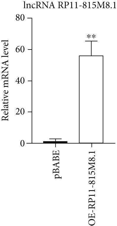 Transfection Efficiency Of The Overexpression And Knockdown Of Lncrna Download Scientific