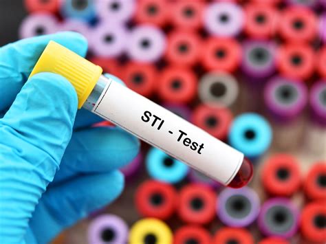Affordable Std Testing Empowers Your Sexual Health