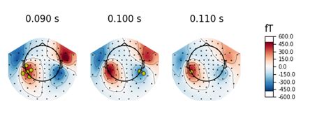plotting topographic maps of evoked data — mne 1 1 1 documentation