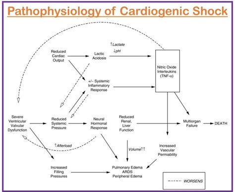 Cardiogenic Shock Cs Causes Symptoms Management We Care