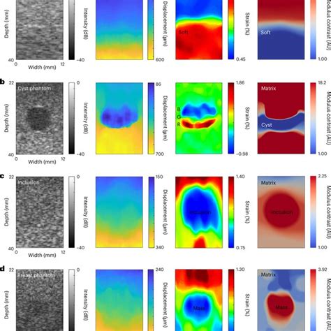 Characterizations On Phantom Models Ad Four Types Of Phantom Are Used Download Scientific