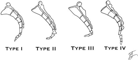 Coccydynia Diagnostic And Management Guidance The Journal For Nurse