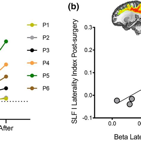 Source Reconstruction Of Oscillatory Longitudinal Effects Post Vs