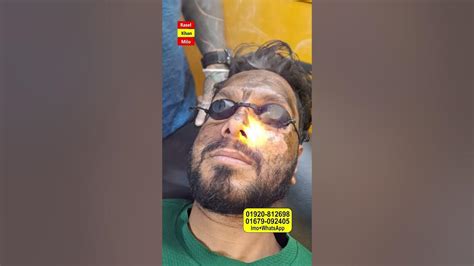 ট্যাটু আঁচিল কাঁটা দাগ রিমুভ হবে চোখের পলকে 😱 আজব এক মেশিন এলো বাংলাদেশে 😱 Youtube