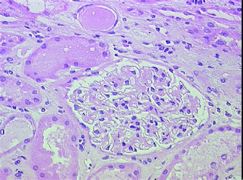 Light Microscopy Image Evidencing A Normal Glomerulus Slight Download Scientific Diagram