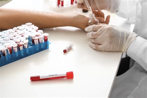 Allergy Testing Elite Primary Care And Vein Clinic