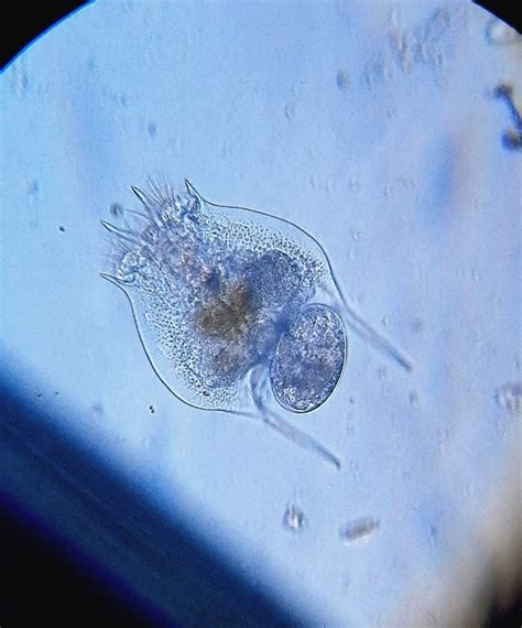 Brachionus Quadridentatus From Новосибирск Новосибирская область Россия On June 18 2024 At 10