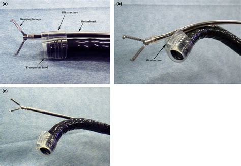 Table 2 From Current Status And Feasibility Of Endoscopy Full Thickness Resection Comparison