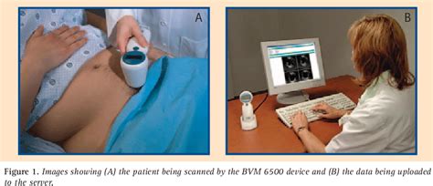 Figure 1 From Automatic Measurement Of Ultrasound Estimated Bladder Weight Uebw From Three