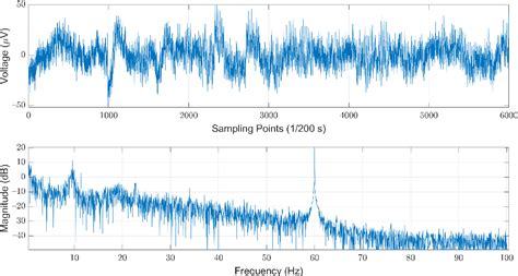 Figure 2 From Automatic Sleep Arousal Detection With Single Lead Eeg