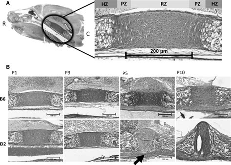 Histologic Analysis Of Pss Closure In Dba 2j Mice A Photograph Of A Download Scientific