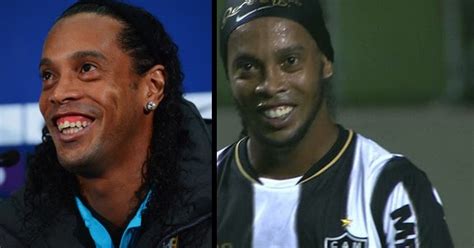 Ronaldinho Gets Teeth Fixed Loses Trademark Smile Inside World Soccer