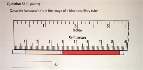 Solved Question 51 3 Points Calculate Hematocrit From The