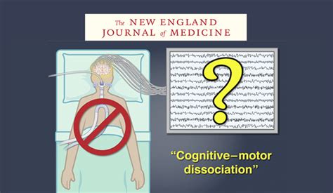 Everything You Wanted To Know About Cognitive Motor Dissociation In