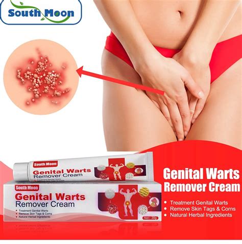 Potters Asttee Genital Warts Are A Sexually Transmitted