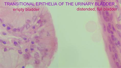 Transitional Epithelium Urinary Bladder