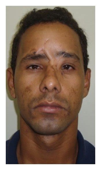 Clinical Preoperative Evaluation Download Scientific Diagram