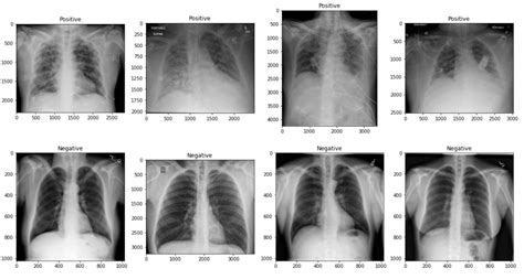 Covid X Ray Image Classification With Efficientnet Covid X Ray Image
