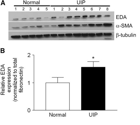 Figure 1 From An Essential Role For Fibronectin Extra Type Iii Domain A In Pulmonary Fibrosis