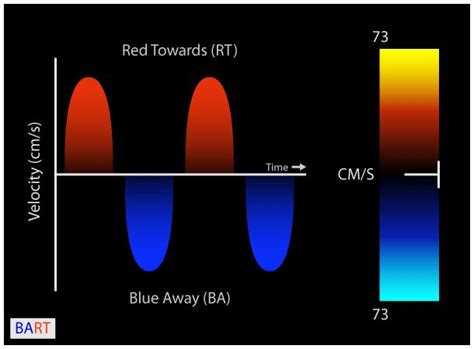 Color Doppler Flow Virtual Tee Colour Color Doppler Standard Views