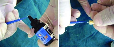 The Realseal Primer Dispensed On To A Microbrush The Primer Applied On Download Scientific